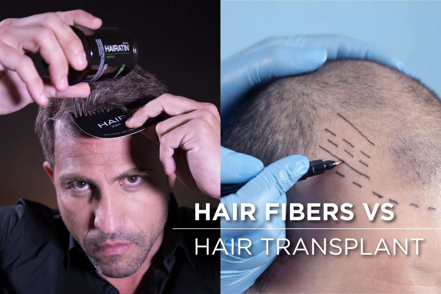 Hairatin | Hair Fibers vs. Hair Transplant